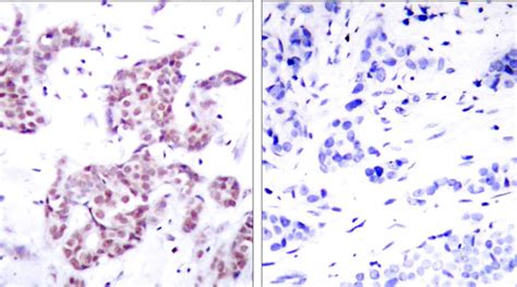 Stat6 Phospho Tyr641 Antibody