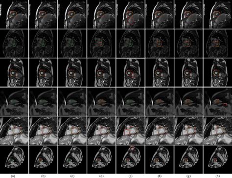 Figure 3 From A Convolutional Neural Network Combining Discriminative