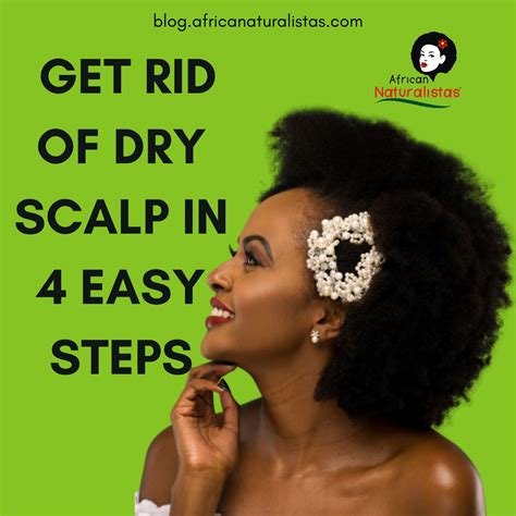 GET RID OF DRY SCALP IN EASY STEPS African Naturalistas
