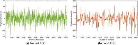 Sample EEG Test Signals Considered In This Study Download Scientific Diagram