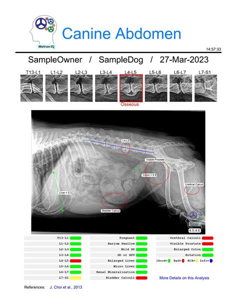 Metron Iq — Metronmind