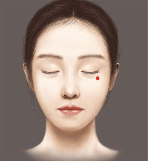 The Art And Science Of Filler Injection Based On Clinical Anatomy And