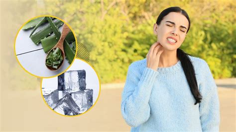 Heat Rashes Remedies கோடையில் ஏற்படும் வியர்க்குருவை நீக்க இந்த ஐந்து பொருள்களை மட்டும் யூஸ்