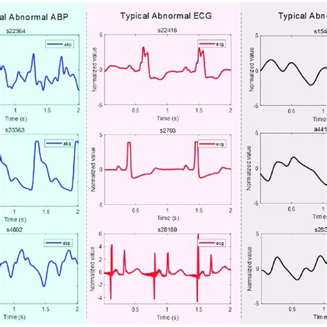 Summary Of Pearson Correlation Coefficient R Strengths Note This Download Scientific