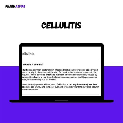 Cellulitis Study Guide Diagnosis Treatment And Management Etsy