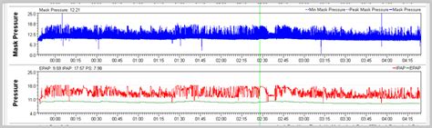 File Oscar Pressure Png Apnea Board Wiki