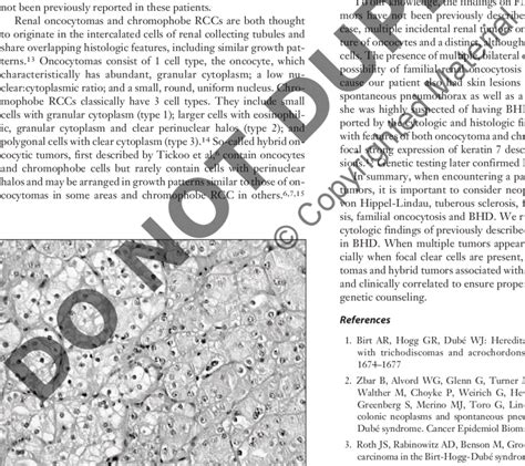 Hybrid Oncocytic Tumor With Areas Microscopically Resembling Oncocytoma Download Scientific