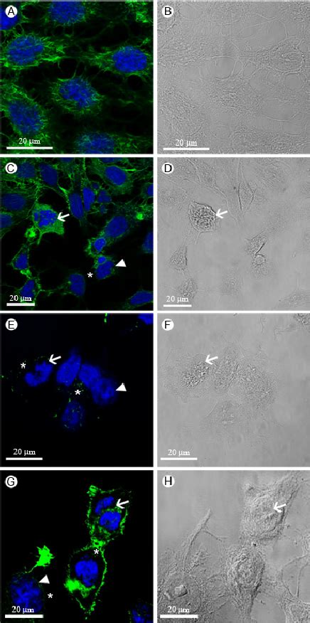 Nuclear Fragmentation And Reduction Of Actin Filaments In Mcf 7 Breast Download Scientific