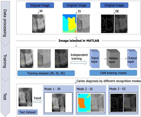 Figure 1 From Detecting Proximal Caries On Periapical Radiographs Using Convolutional Neural