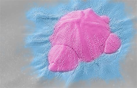 Somatic Mutations Somatic Mutation Detection In Cancer Research