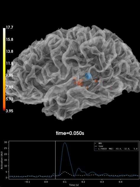 Plotting The Full Vector Valued Mne Solution — Mne 1101 Documentation