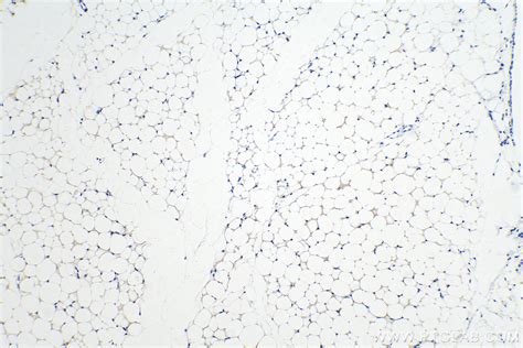 Ihceasy Cidea Ready To Use Ihc Kit Khc0244 Proteintech 武汉三鹰生物技术有限公司