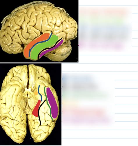 Temporal Lobe Anatomy Diagram Quizlet