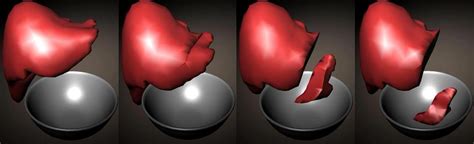 Volccd Fast Continuous Collision Culling Between Deforming Volume Meshes