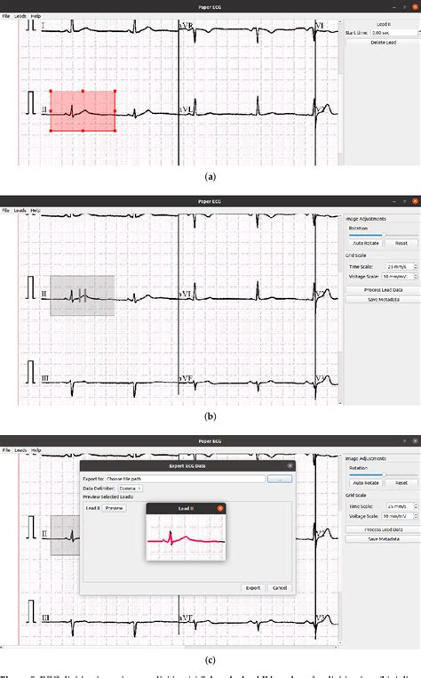 table 1 from cardiac arrhythmia classification using advanced deep learning techniques on
