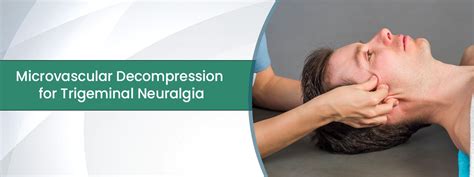 Microvascular Decompression For Trigeminal Neuralgia