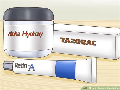 Ways To Erase A Pimple Scar Wikihow