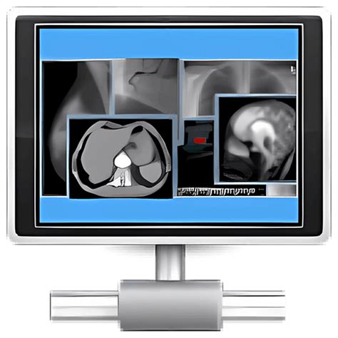 Sante Pacs Server Pg 官方免费下载试用中心