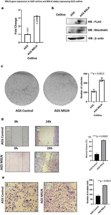 Mesothelin Promotes Oncogenic Properties In Gastric Cancer Cell Line Download Scientific