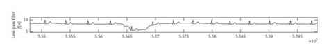 The Phases Of Qrs Complex Detection In F1o09 Case A Low Pass Filter Download Scientific