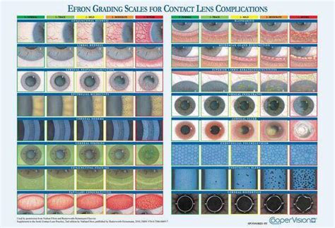 Contact Lens Grading Scales Eriknholt