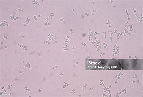 Sel Ragi Tunas Dengan Pseudohyphae Dalam Sampel Urin Foto Stok Unduh Gambar Sekarang Istock