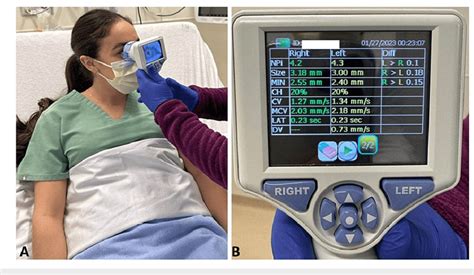 A Nurse Taking Automated Pupillometer Reading B Automated Download Scientific Diagram