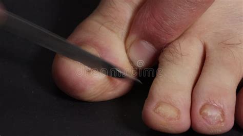 The Procedure Of Treating Toenails With A Special Pedicure File Stock Footage Video Of