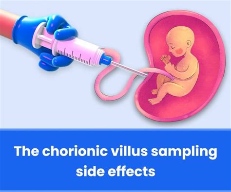 The Chorionic Villus Sampling Side Effects