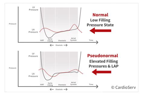 Understanding The Basics Lv Filling Patterns Cardioserv