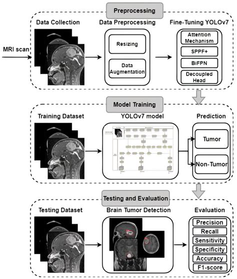 Overview Of The Proposed Brain Tumor Detection Based On Optimized