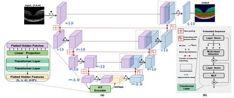 Transegnet Hybrid Cnn Vision Transformers Encoder For Retina Segmentation Of Optical Coherence