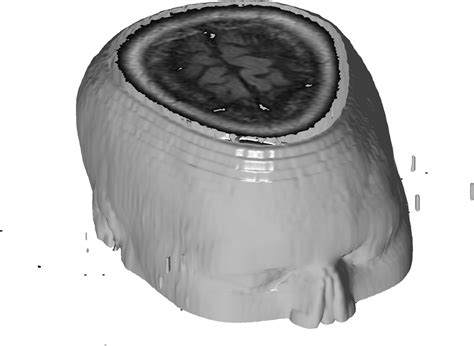 3d Visualization Of Mri Slices Re Casted Into An Array 256 × 256 × 24 Download Scientific Diagram