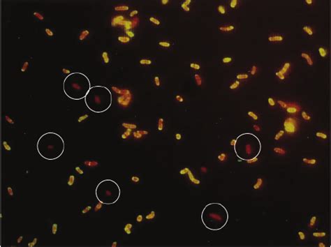 eburst ‘population snapshot of allelic profiles based on the current