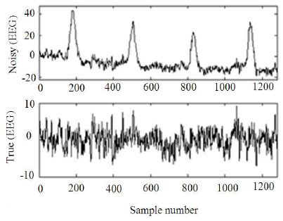 EEG Contaminated With Noise Producing Spikes Vs Same Without Download Scientific Diagram
