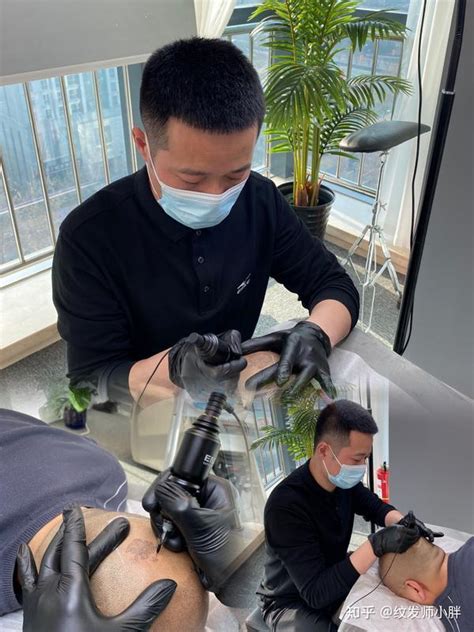 地中海脱发遗传吗？ 知乎