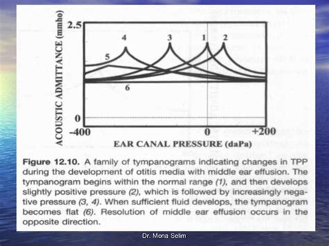 Tympanometry And Clinical Applications