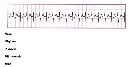 Solved Rate Rhythm P Wave PR Interval Chegg Com