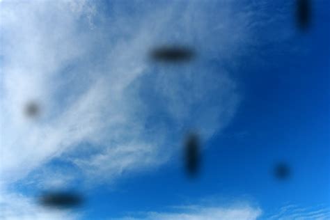 My Personal Experience With Floaters And Flashers Clinica London