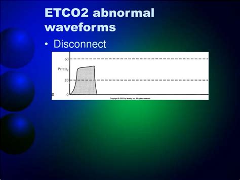 Ppt Non Invasive Monitors Powerpoint Presentation Free Download Id 5615089