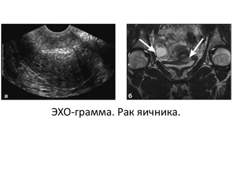 Лучевая диагностика заболеваний эндокринной системы презентация онлайн