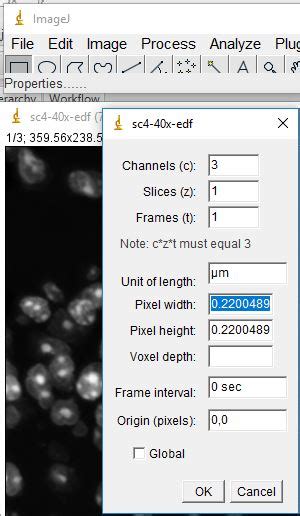 automatic quantification issue · issue 163 · qupath qupath · github