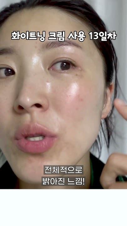 13일차 수분공급 멜라닌 색소 억제 활성산소 제거까지 한번에 해결해주는 인생템 등장😊 Youtube