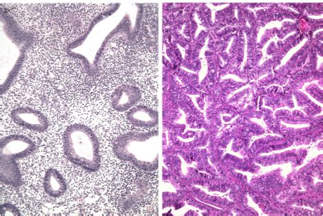 Secondary Sex Organs Flashcards Quizlet