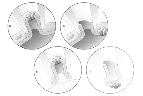 3 Different Patch Clamp Configurations Cell Attached A Whole Cell