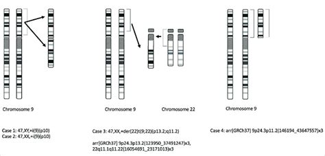 Schematic Drawings Of The Observed Chromosomal Aberrations Case 1 2 Download Scientific