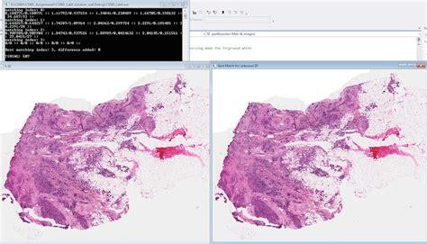 Cancer Tumor Processing With Opencv Moo Ack Productions