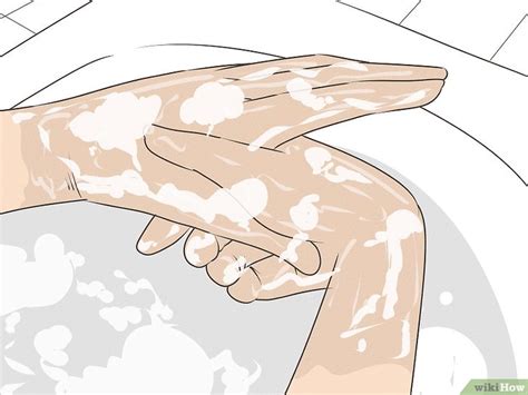 How To Remove A PICC Line In Steps