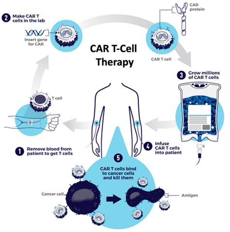 百年细胞治疗史，car T未来如何突破？car T肿瘤新浪新闻