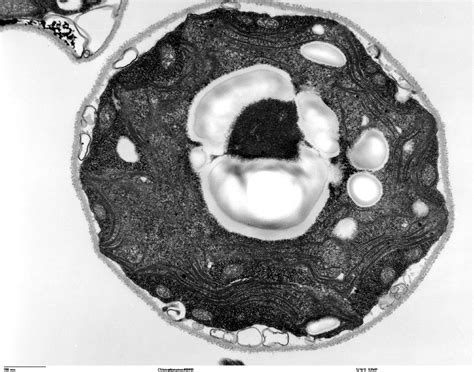 Transmission Electron Microscope Image Showing An Example Of Green Algae Chlorophyta